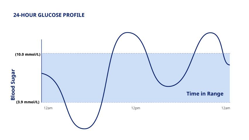 Using Time in Range (TiR) and HbA1c together to help manage your diabetes